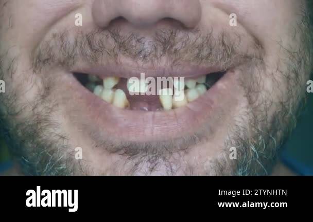 The stupid man Stock Videos & Footage - HD and 4K Video Clips - Alamy