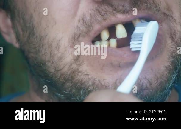 toothless man brushing his teeth. loose teeth in a middle-aged man ...