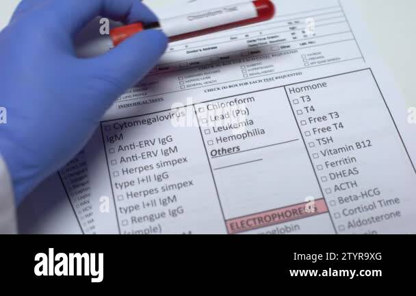 Chloroform poisoning Stock Videos & Footage - HD and 4K Video Clips - Alamy
