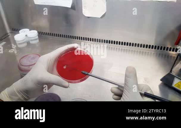 inoculation of pus sample in a blood agar culture plate by an ...