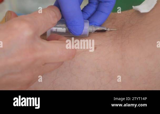 Blood sampling at a medical facility. Test tubes with blood on the palm ...