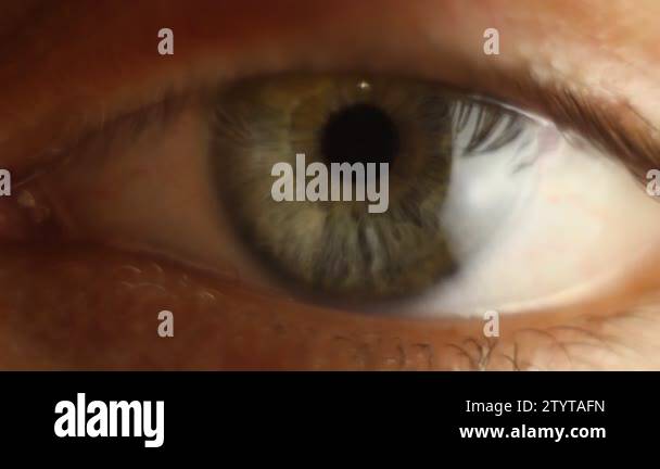 blinking male eye close-up looking around. red artery on the eyeball ...