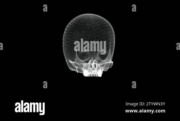 Hologram screen of skull Cranium without mandible bone in the human ...