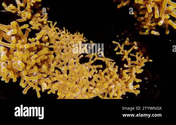 Tuberculosis bacillus in the lung.Tuberculosis is an infectious disease ...