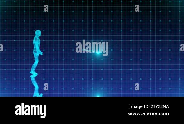 ECG cardiac monitor goes flat line. ECG showing a pulsing heart rate ...