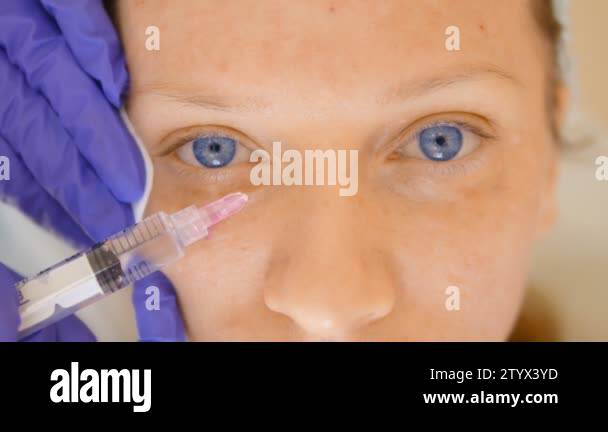 close up, needle enters skin under eyes. blue female eyes are looking ...