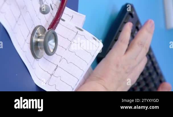 Electrocardiogram tracing paper Stock Videos & Footage - HD and 4K ...