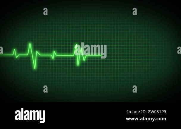 Heartbeat Heart Rate Pulse ekg rhythm Animation , Heartbeat Heart Rate ...
