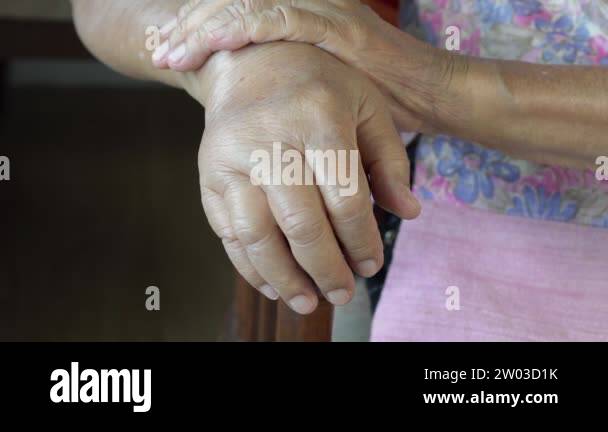 Edema hand Stock Videos & Footage - HD and 4K Video Clips - Alamy
