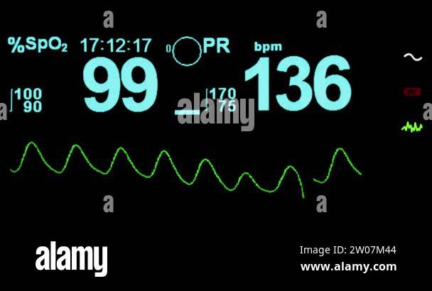 symbol graph of electrocardiogram ecg in hospital surgery operating ...