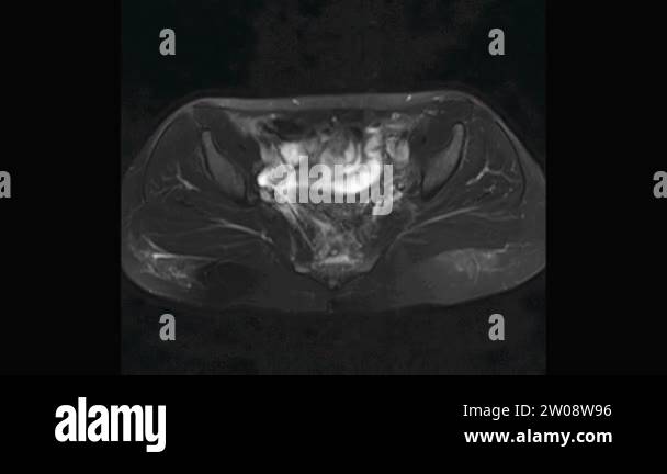 Contrast MRI scan of the abdominal cavity and retroperitoneal space ...