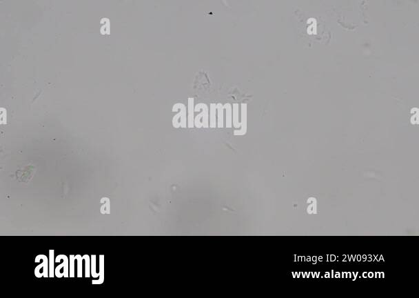 Trypanosoma cruzi microscope view; agent of the human killing Chagas ...