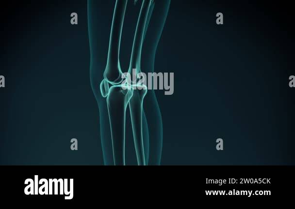 Knee pain animation. Healthy joint and unhealthy painful joint with ...