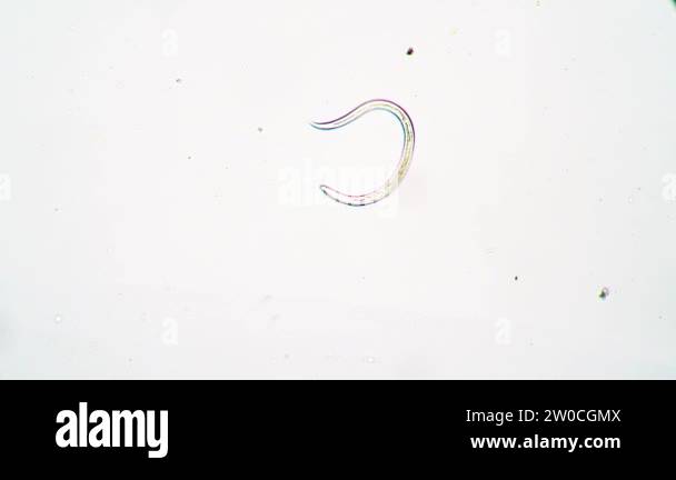 Nematode worm on a white background in center of frame under a microscope Stock Video Footage ...