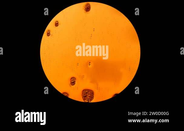 microbes, bacteria under microscope Stock Video Footage - Alamy