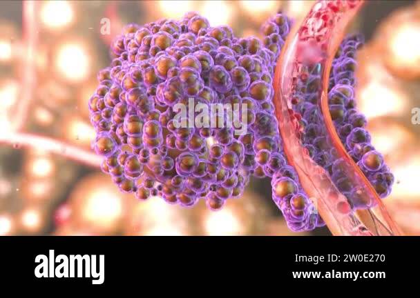 Mutating blood cell. AIDS. Blood cancer (oncology, leukemia, anemia ...