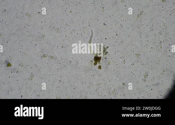 Microscopy parasite worm nematode strongyloides Stock Videos & Footage - HD and 4K Video Clips ...