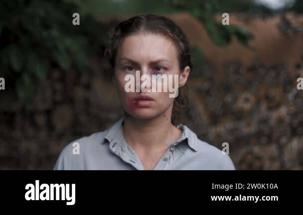 Portrait of an abused woman with face full of bruises. Stop domestic ...