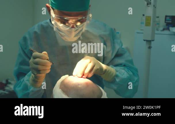 Baldness treatment. Hair transplant. Surgeons in the operating room ...