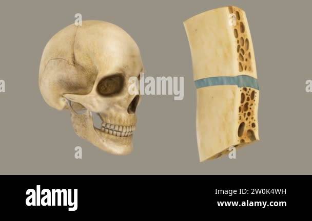 Inside of the femur bone Stock Videos & Footage - HD and 4K Video Clips ...