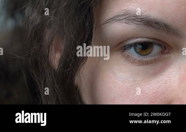 Conjunctivitis overwork Stock Videos & Footage - HD and 4K Video Clips ...