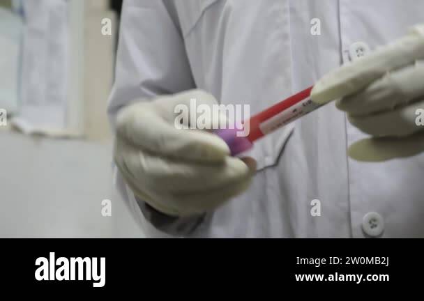 upside down tilting and inverting of blood sample tube to mix blood ...