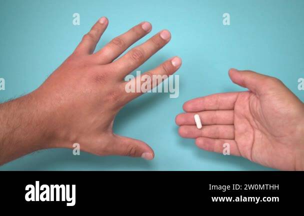 Male hand stung by bee and medication for swelling next to it. Hand ...