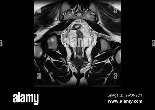 Contrast MRI scan of the abdominal cavity and retroperitoneal space ...