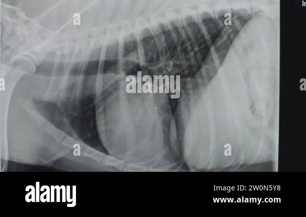 Normal chest radiograph Stock Videos & Footage - HD and 4K Video Clips ...