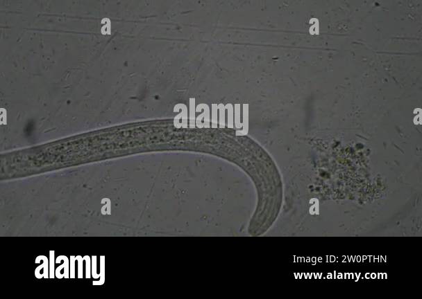 Strongyloides stercoralis larva in stool exam.Parasite in human Stock ...