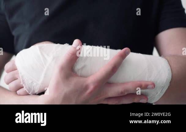 Broken arm plaster hospital Stock Videos & Footage - HD and 4K Video ...