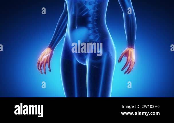 WRIST bone skeleton x-ray scan Stock Video Footage - Alamy