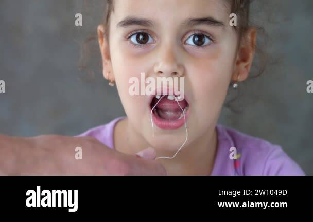 The hands of an adult pull the thread tied to the childs tooth. Failed ...