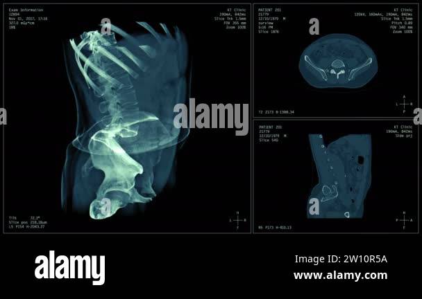 Body CT scan image, radiography x-ray examination, MRI tomography ...