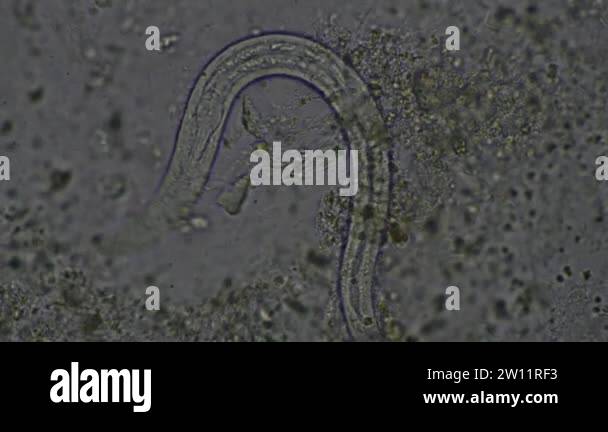 Strongyloides stercoralis larva in stool exam.Parasite in human Stock ...
