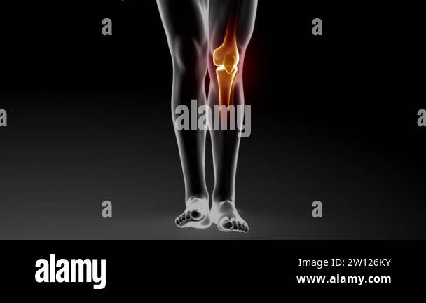 Pain in knee joints Stock Videos & Footage - HD and 4K Video Clips - Alamy