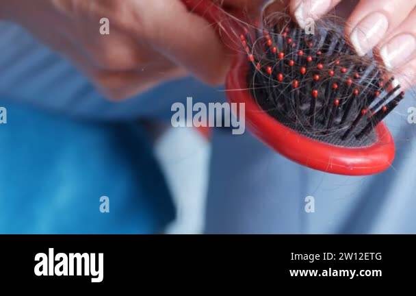 Female hands clean Drop down hair on a comb after combing. Lots of ... Female hands clean Drop down hair on a comb after combing. Lots of ...