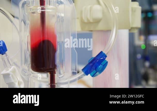 Dialysis machine blood filling Stock Video Footage - Alamy