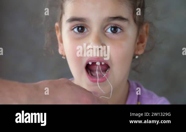 The hands of an adult pull the thread tied to the childs tooth ...