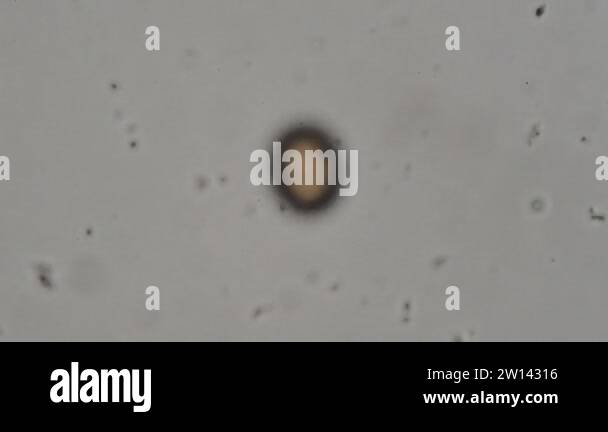 parasite : taenia solium egg from human feces under microscope. testing ...