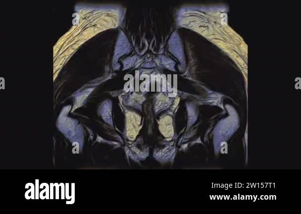 Bulk multicolored MRI of the female pelvic organs, abdominal cavity ...