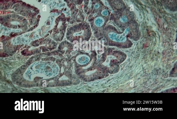Histology colon Stock Videos & Footage - HD and 4K Video Clips - Alamy