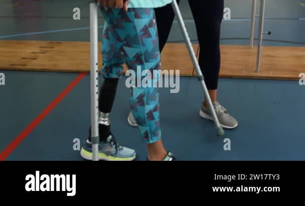 Side view of a Caucasian woman with a prosthetic leg walking on ...