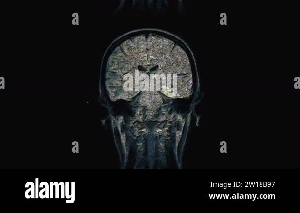 Bulk multicolored MRI brain, head scans and tumor detection. Diagnostic ...