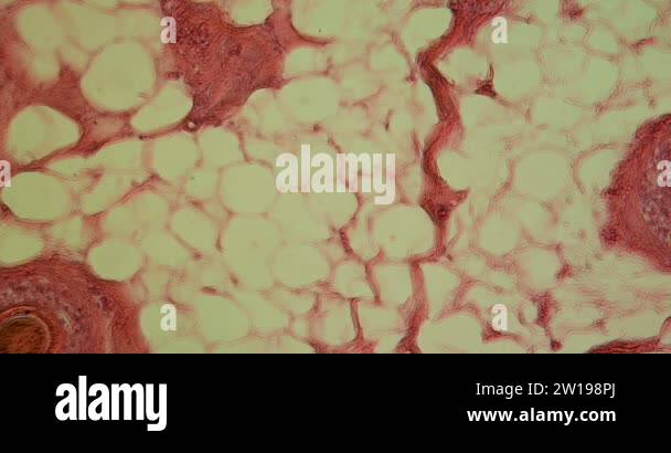 Scalp with hair roots in cross-section greatly enlarged under the ...