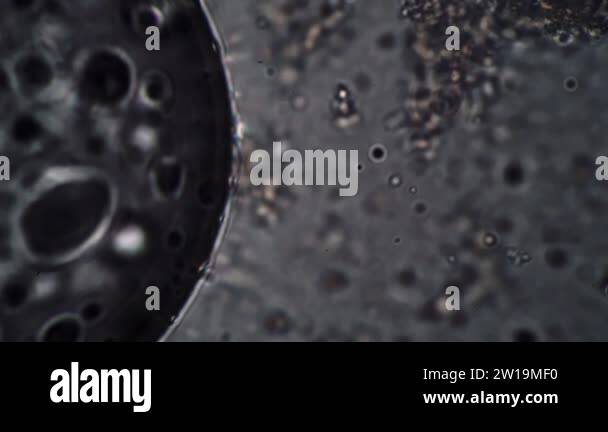 Yogurt bacteria microscope Stock Videos & Footage - HD and 4K Video ...