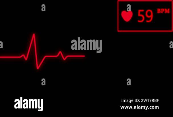 Heart rate meter Stock Videos & Footage - HD and 4K Video Clips - Alamy