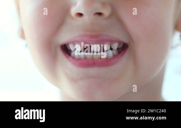 The child shows a wobbling baby tooth. Shakes a tooth language. He ...