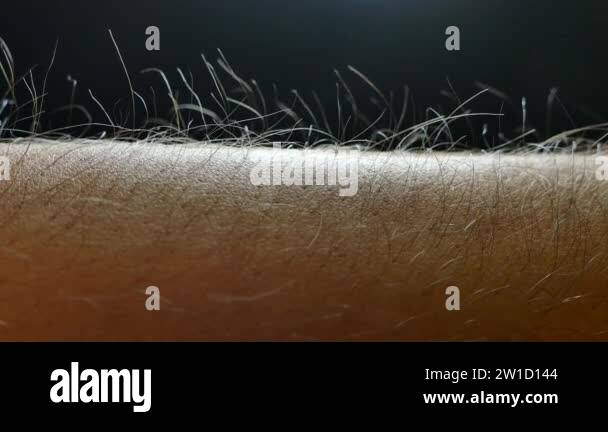 Goosebumps close up. Hair on his hand stand up. Static electricity ...