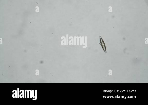 Diatoms and algae Stock Videos & Footage - HD and 4K Video Clips - Alamy